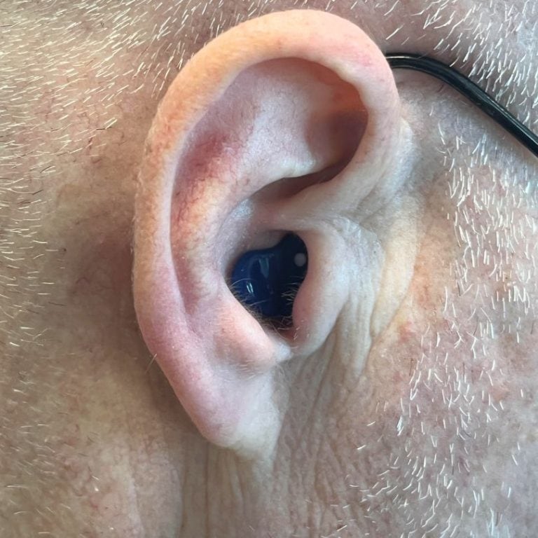 Custom Sleep Earplugs For Side Sleepers | Drifters By VCEP